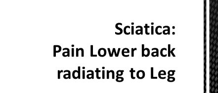 Sciatica: Pain Lower back radiating to Leg – Evolution of Medical ...